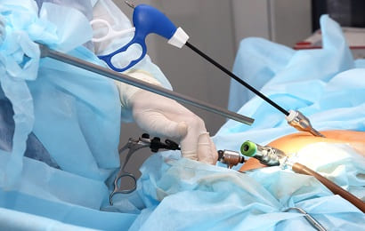 Colecistectomía laparoscópica ofrecido por él Dr. Carlos Morales Camacho